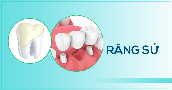 RĂNG SỨ - Nha khoa Diamond Biên Hòa